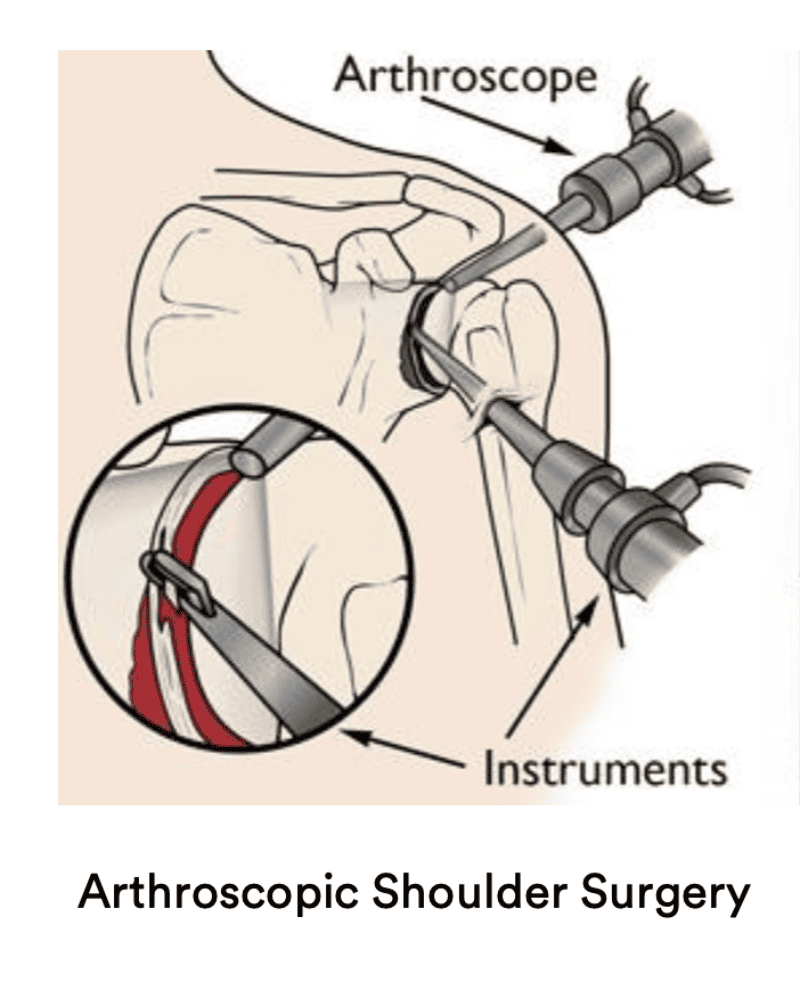 Andy Robertson's shoulder injury: Surgery details and likely return ...